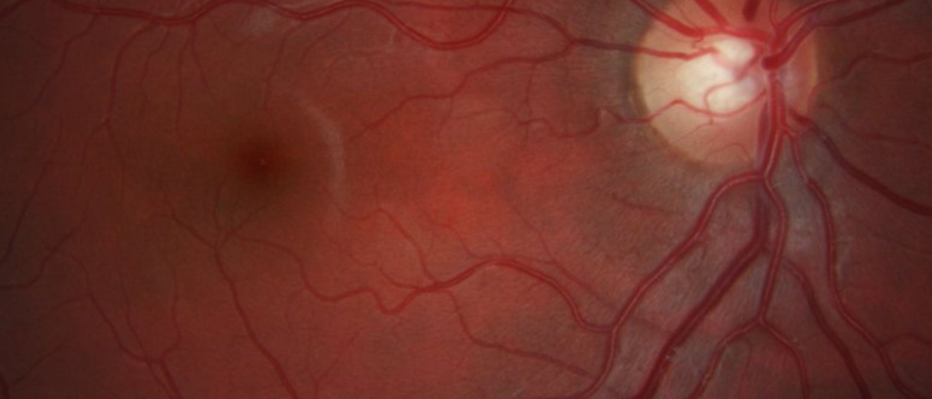 Research | Medical Computer Vision & Graphics Lab - The University of Iowa